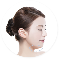 Fat Dissolving Injections in Korea - Three Wishes Clinic in Myeongdong