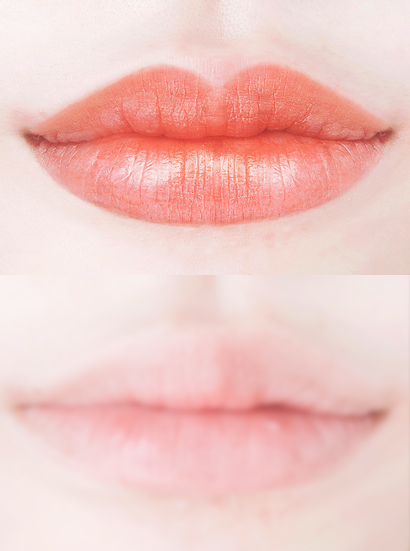 Lip Microblading in Korea - Three Wishes Clinic in Myeongdong