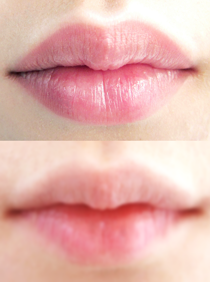 Lip Microblading in Korea - Three Wishes Clinic in Myeongdong